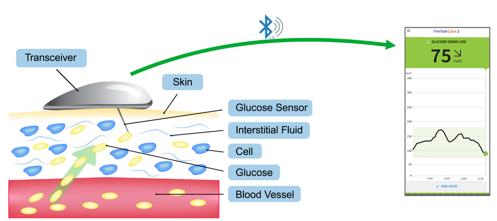 Liberating glucose data from the Freestyle Libre 3